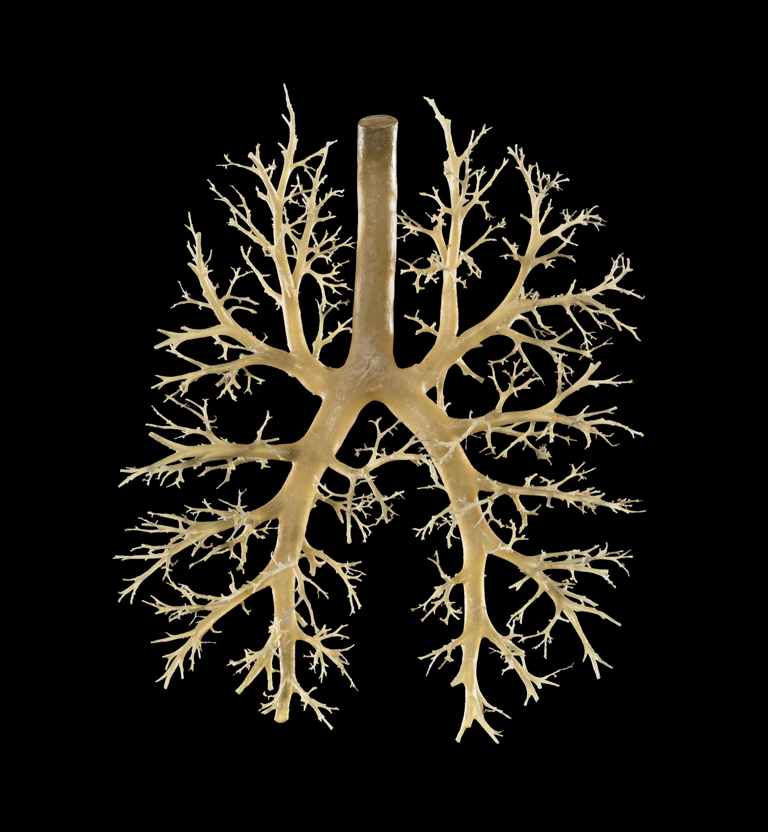 Cast of the trachea, bronchi and bronchioles of a domestic dog ...
