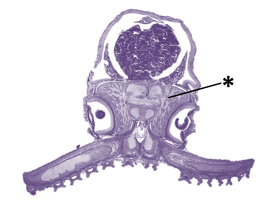 Section through an octopus shows the mouth passing through the brain ...
